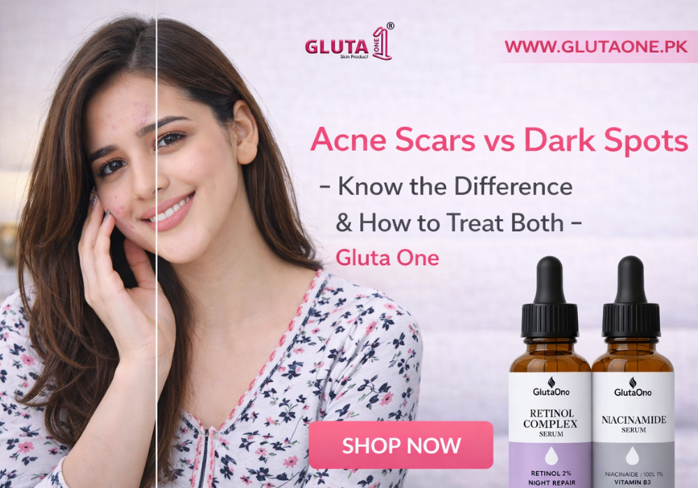 Acne Scars vs Dark Spots - Know the Difference & How to Treat Both - G ...